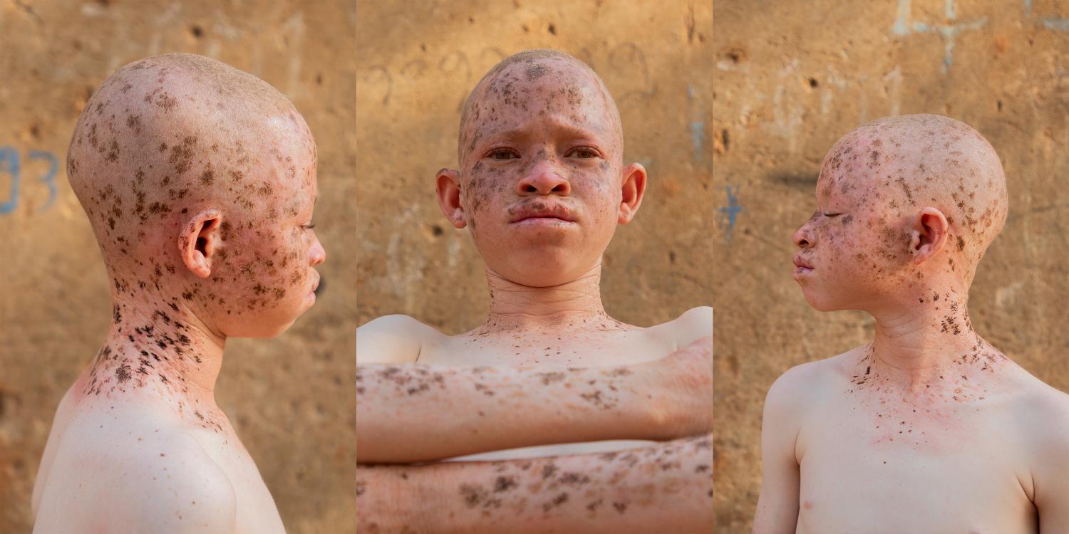 Mali | Challenges and Resilience | John Moussa Kalapo | staging ...